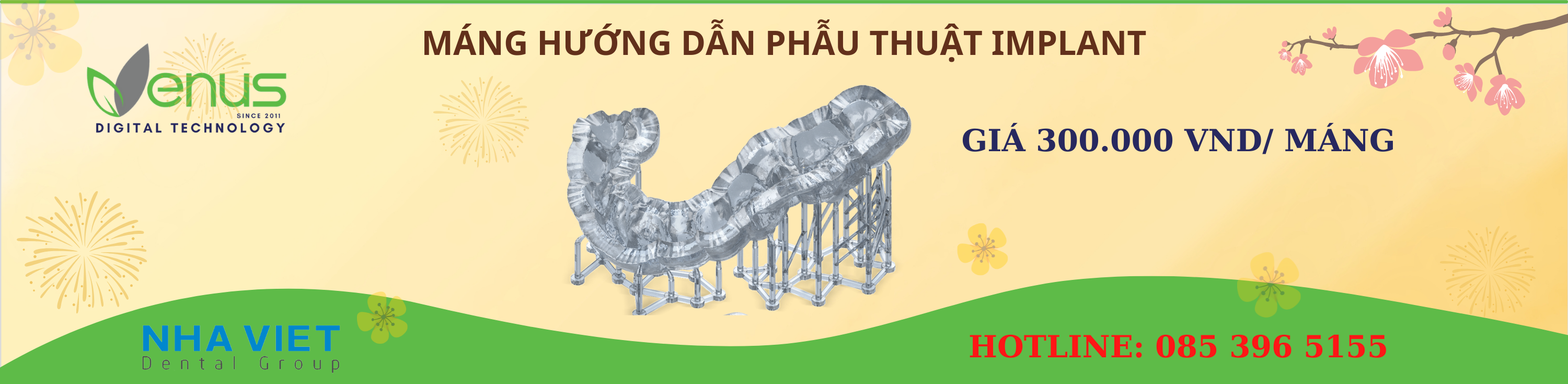 CÔng Ty Tnhh Nha ViỆt Digital